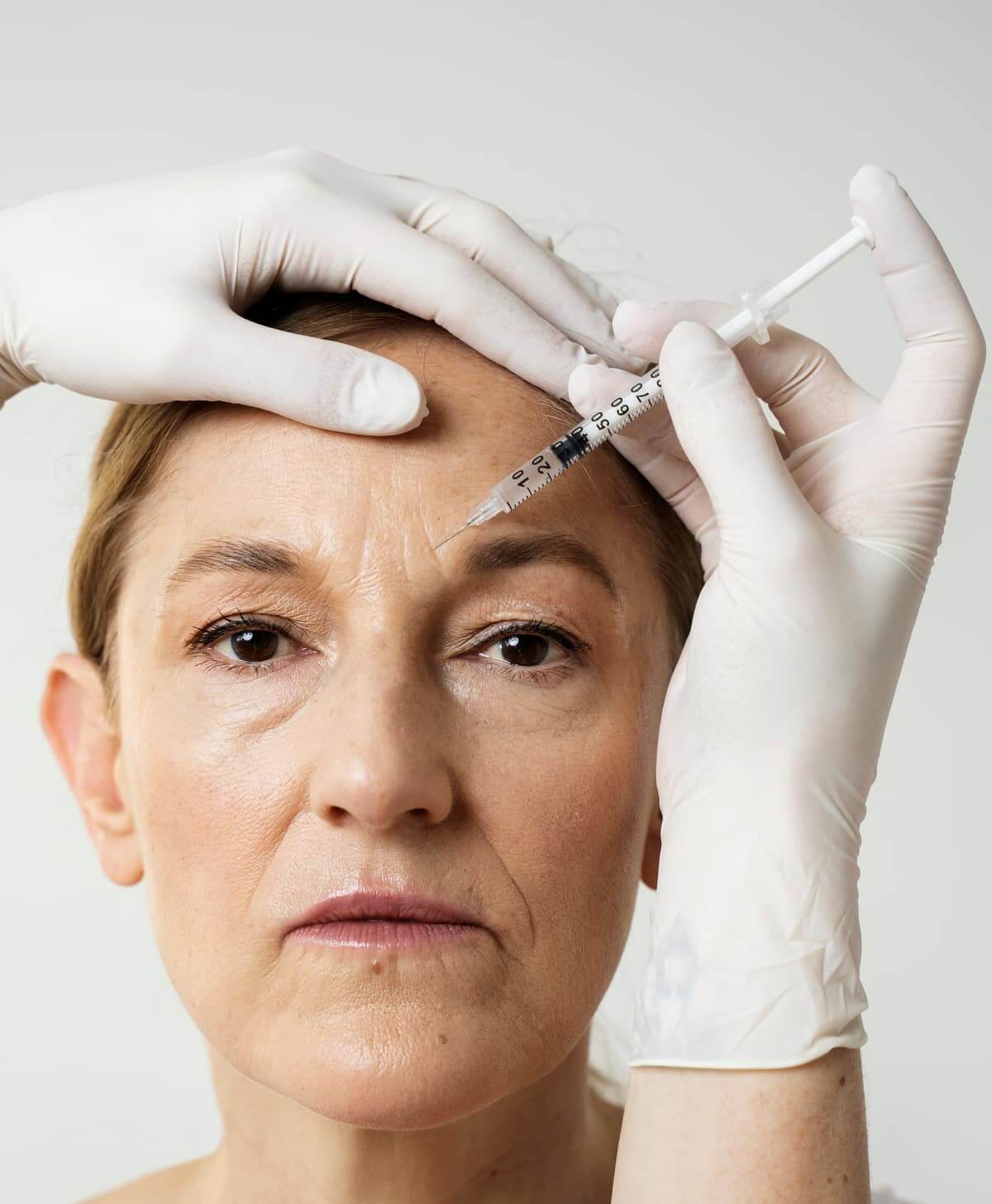 How Much Botox Do I Need for the First Time? - FillerСloud